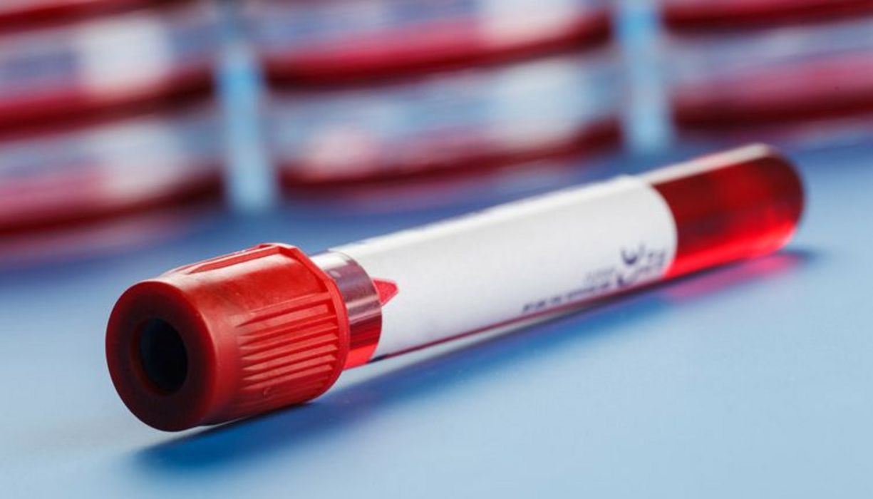 Blutwerte - die sollten Sie kennen | aponet.de