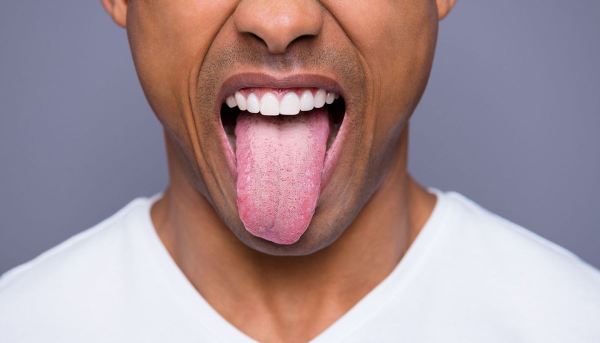 Künstliche Intelligenz erkennt Krankheiten an der Zunge | aponet.de