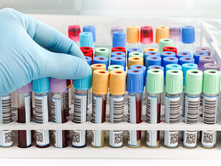 Das Blutbild verstehen | aponet.de